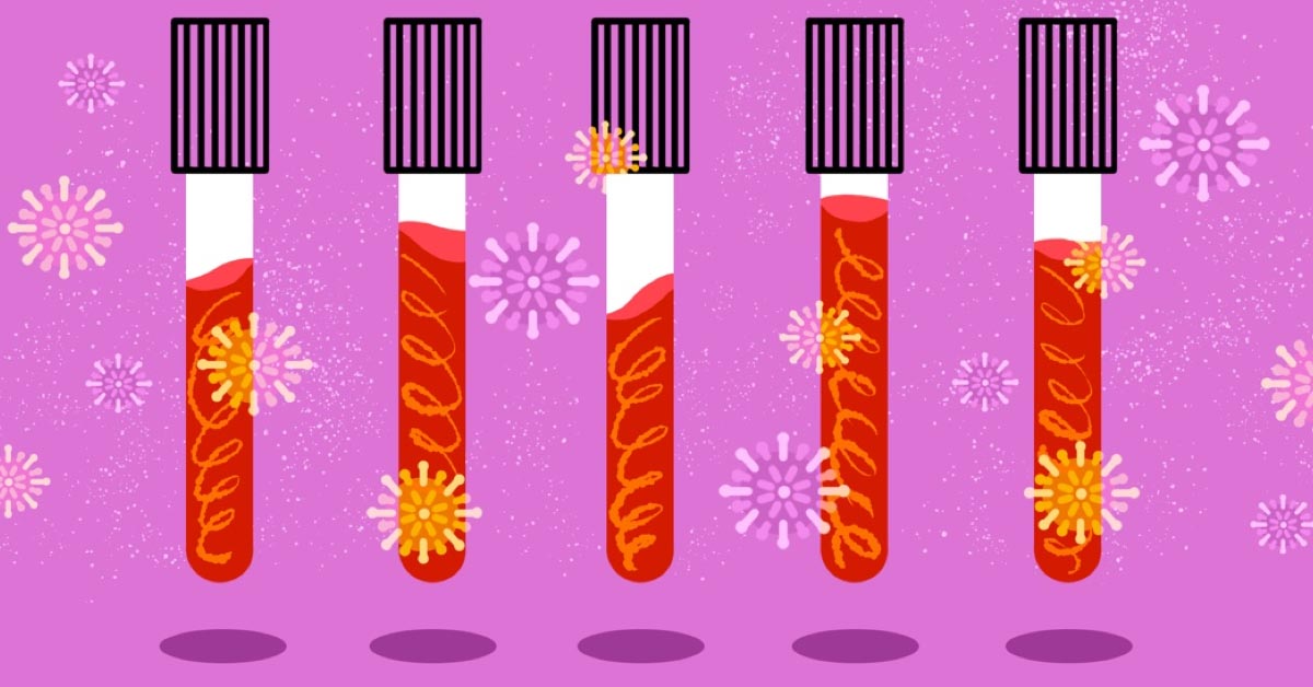 Getting Tested Regularly | H-I-V.net