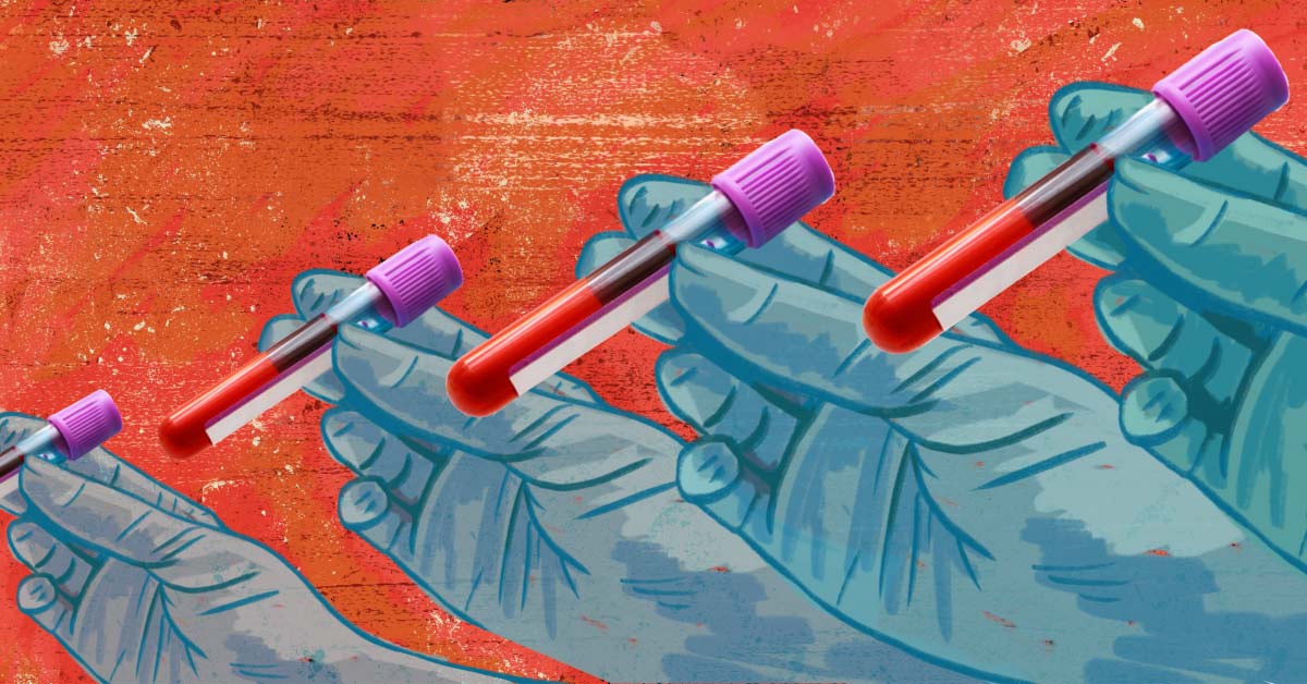 How Often Should I Get Tested for STDs and HIV?